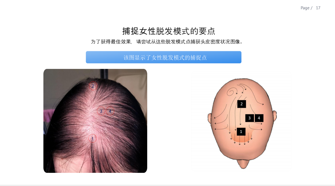 采美365网- Harris Hair DP头皮分析仪