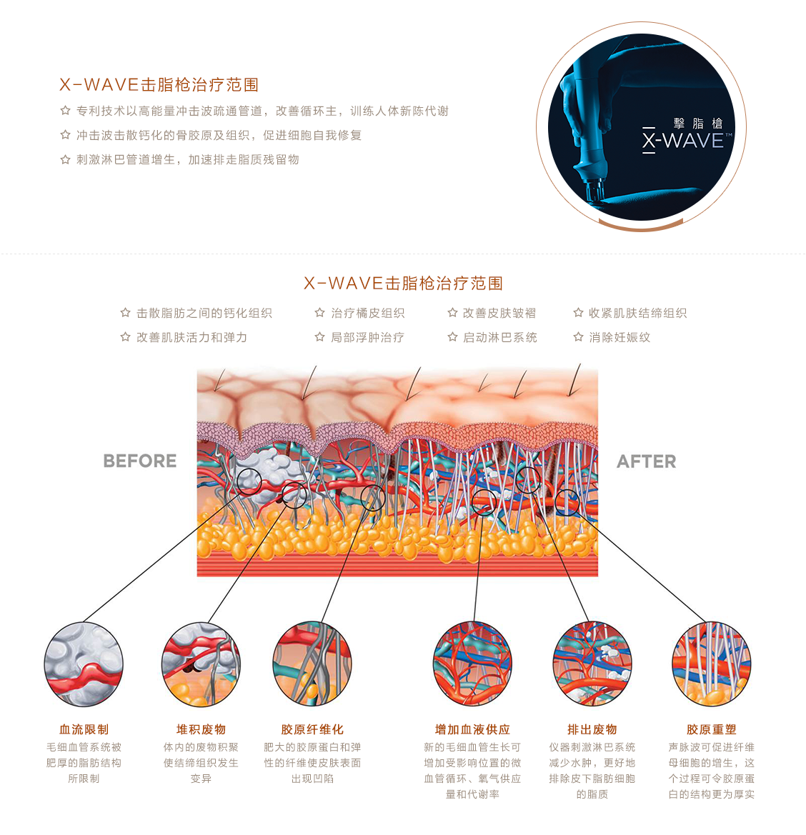 采美365网-采美正品仪器X-Wave 击脂枪